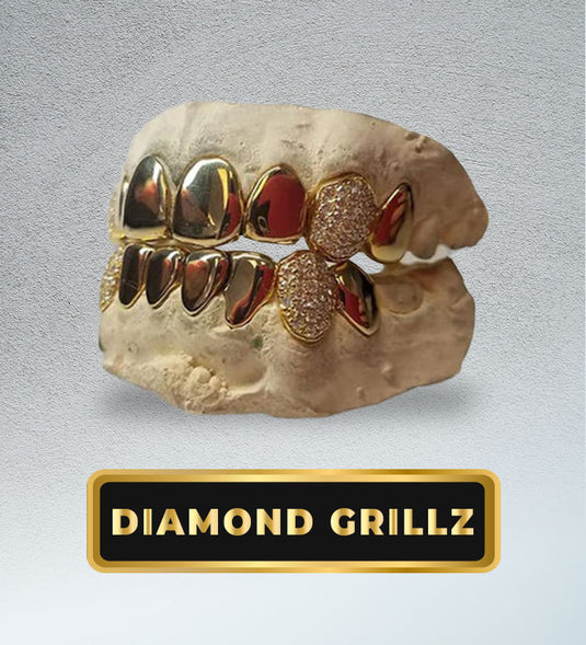 Solid Gold Custom Grillz | Silver & Gold Teeth - Grillz Godz